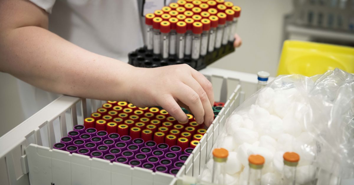 Det tas for mange prøver - Helse Sør-Øst RHF